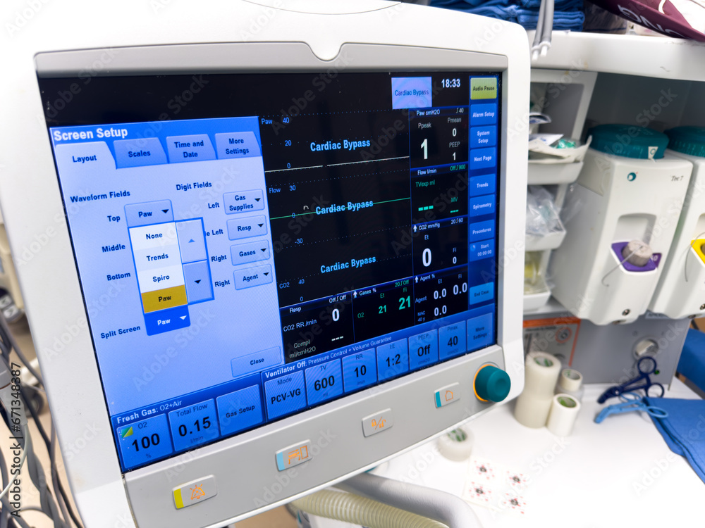 hospital monitor displaying vital signs: blood pressure, heart rate ...