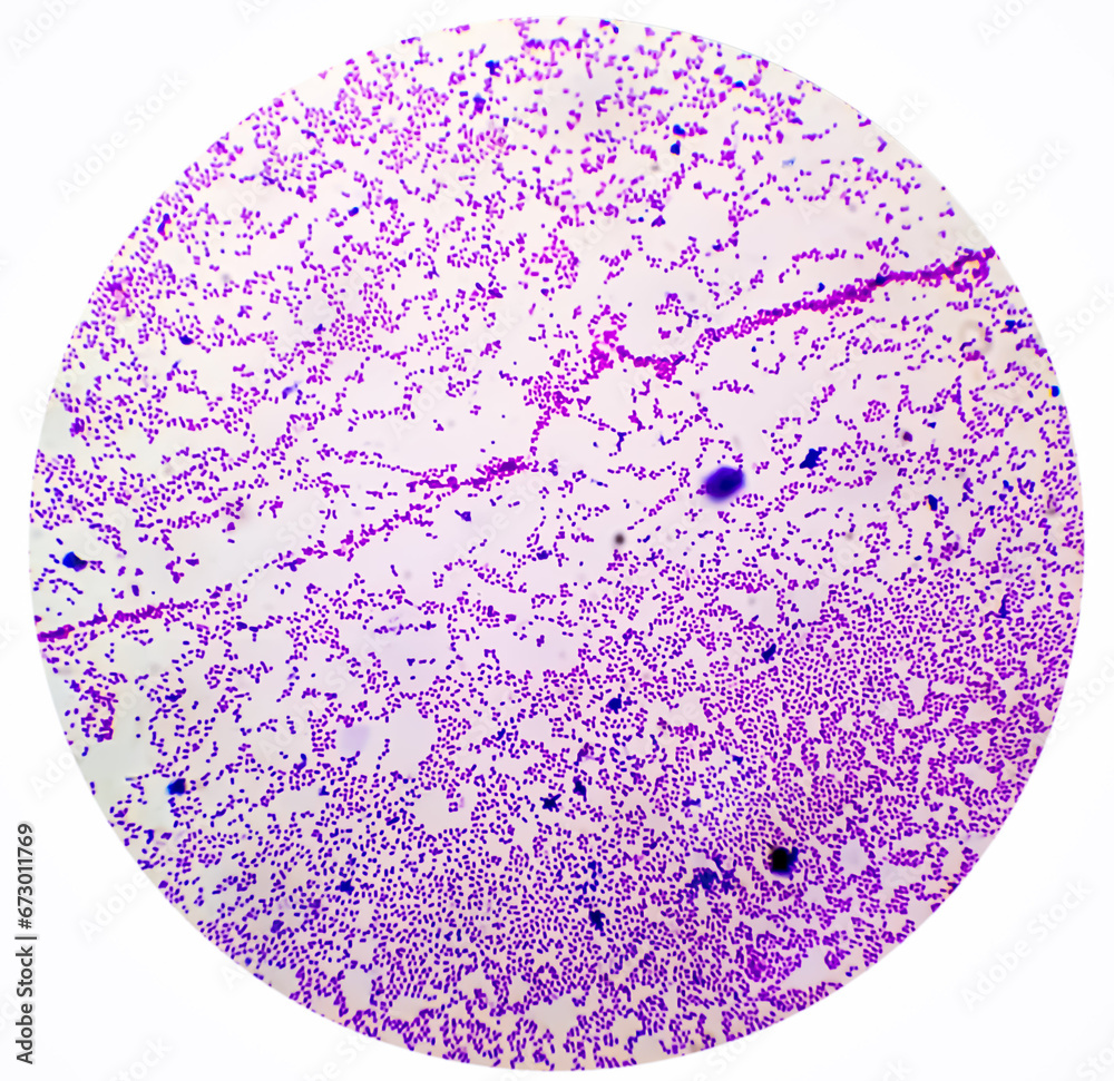 Bacterial colonies gram stained microscopic show Staphylococcus aureus ...