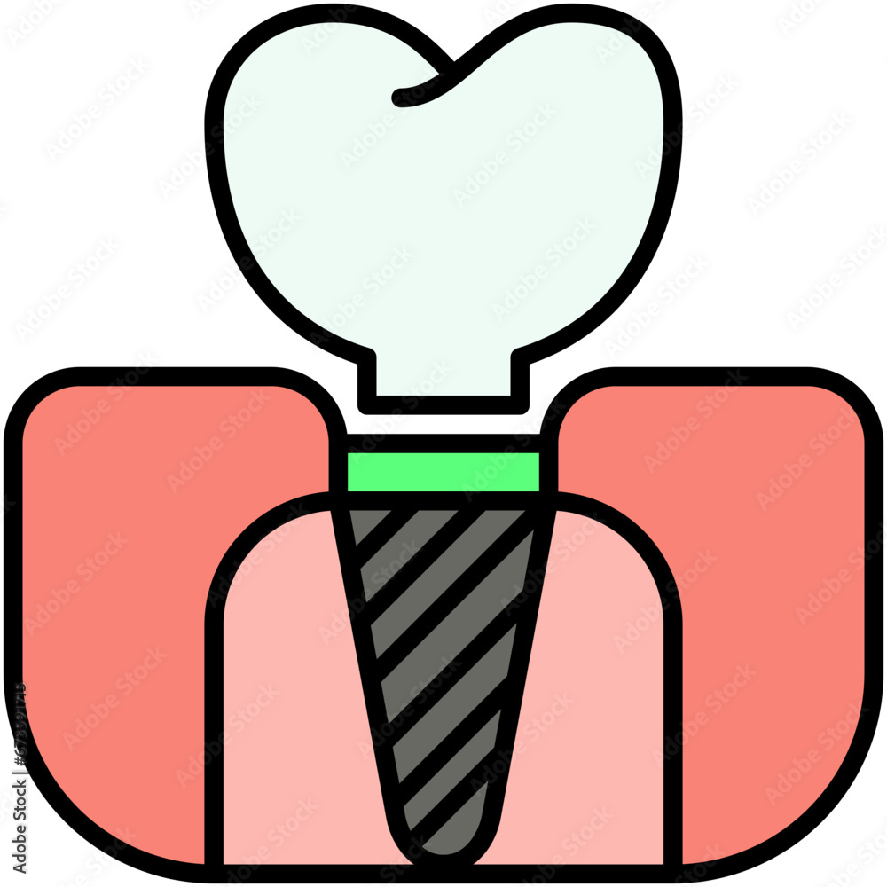 Dental Implant Icon. Prosthetic Tooth Crown Symbol Stock Illustration ...