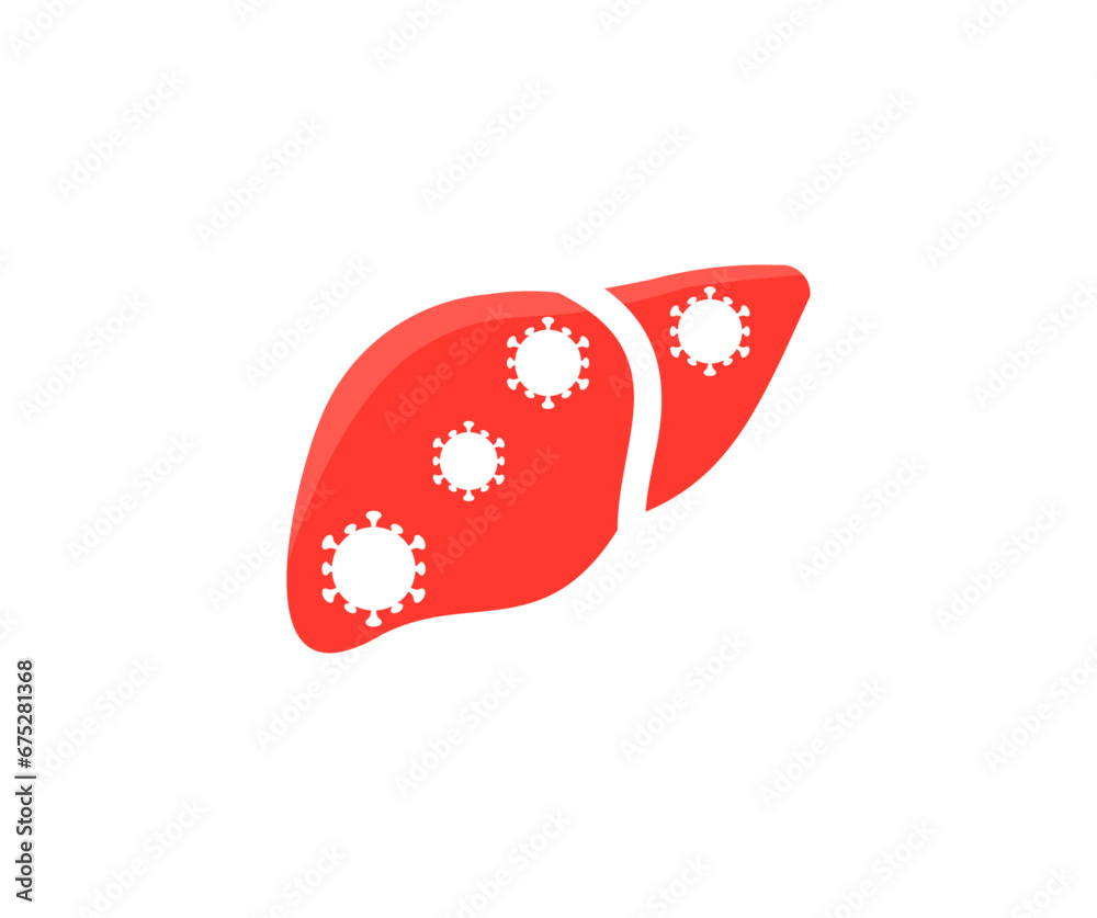 Liver organ infected with virus. Hepatitis liver. Hepatic disease ...