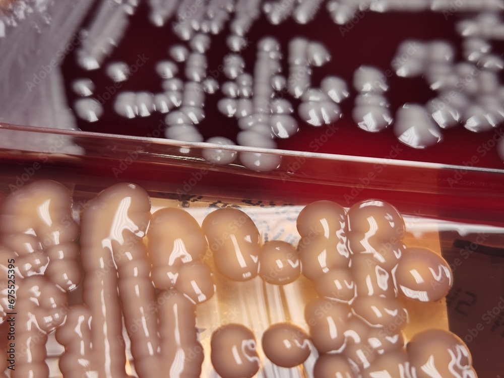 Klebsiella pneumoniae bacteria growing on blood and Macconkey agar ...