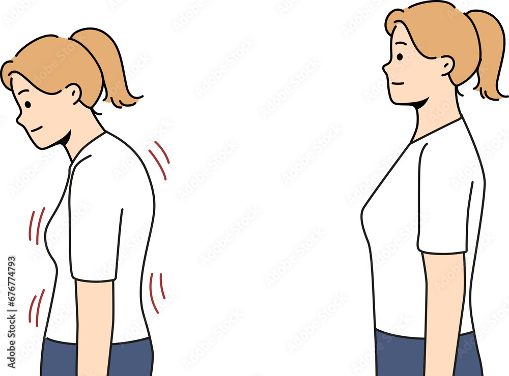 Stooped woman before and after correcting posture thanks to massage ...