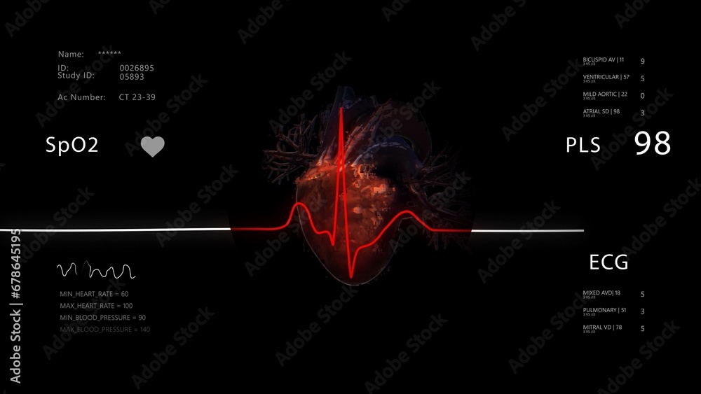 Heart beat. Heart rate monitor MRI x ray CT Scan. Futuristic ...