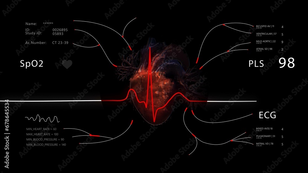 Heart beat. Heart rate monitor MRI x ray CT Scan. Futuristic ...