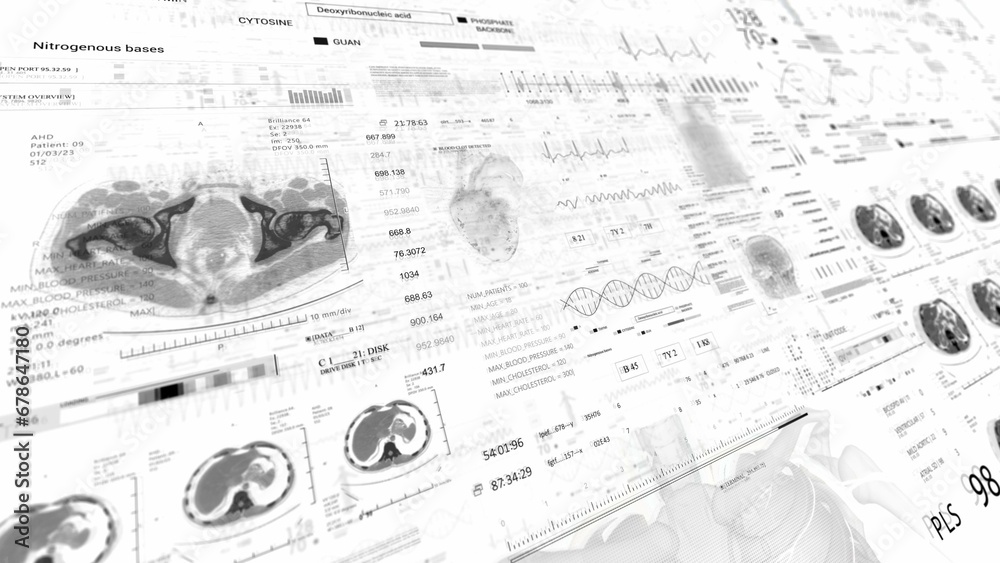 Medical HUD monitoring MRI x ray CT Scan. Healthcare.Heart rate monitor. Futuristic ...