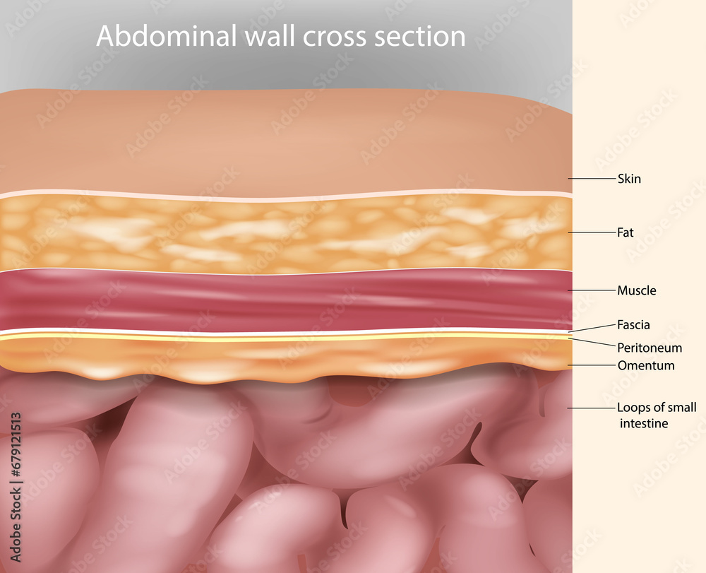 Abdominal wall cross section Anatomy. Abdominal wall layers Stock ...