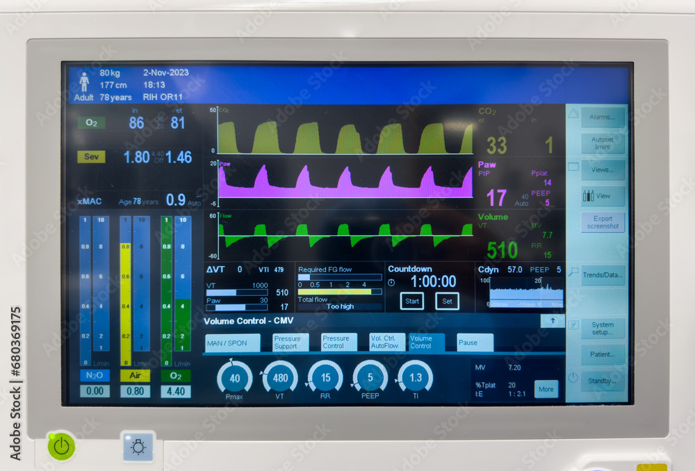Hospital monitor displaying vital signs: heart rate, blood pressure ...