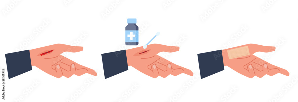 First aid for treating cut wound on hand. Treatment stages process for ...