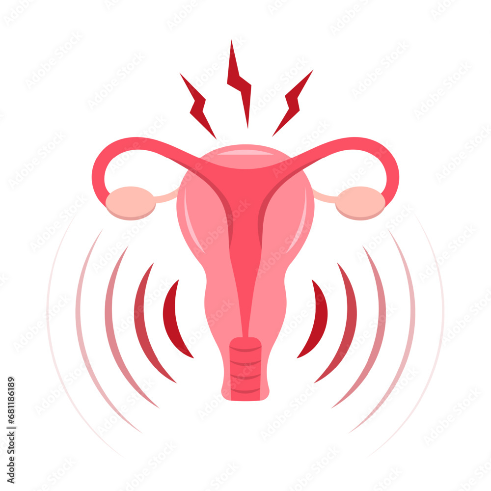 Menstrual pain and cramps - vector illustration. Red pain circles on ...