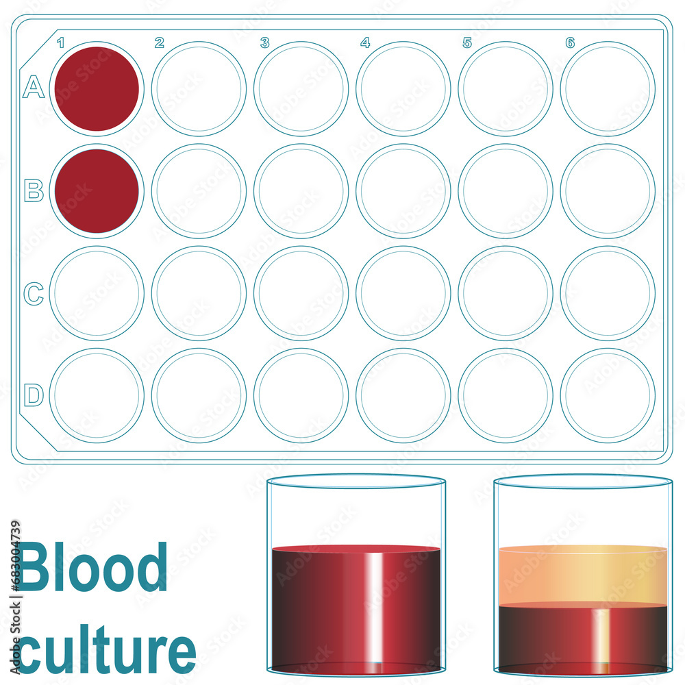 Deep well plate for whole blood culture seen from above and detail of a ...