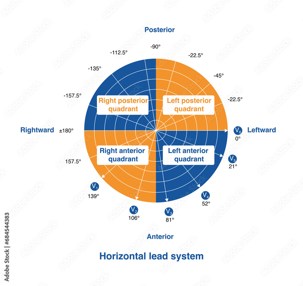 The horizontal lead system is the reference plane for chest leads ...