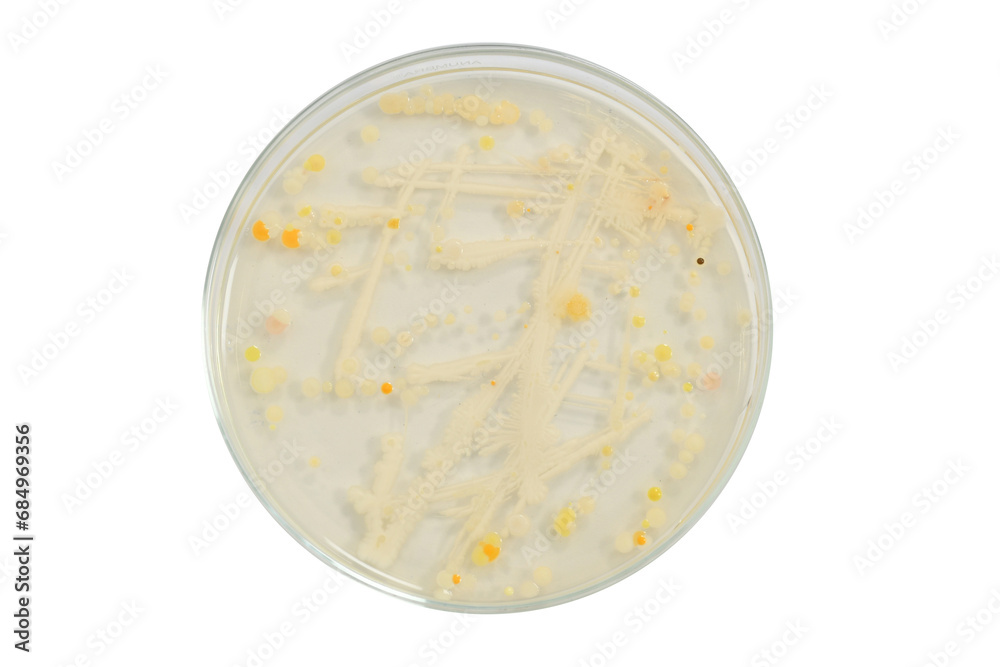 Bacteria. Microbiology. Bacterial colony morphology. Bacterial growth ...