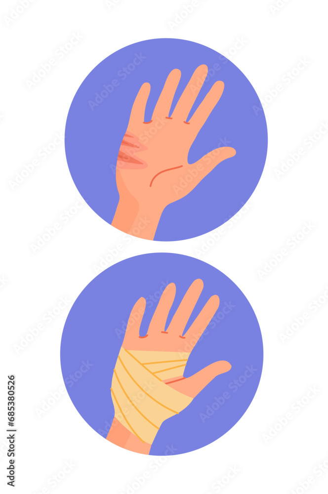 Types of bandages set. Swathe for cure palm. Health care and treatment ...