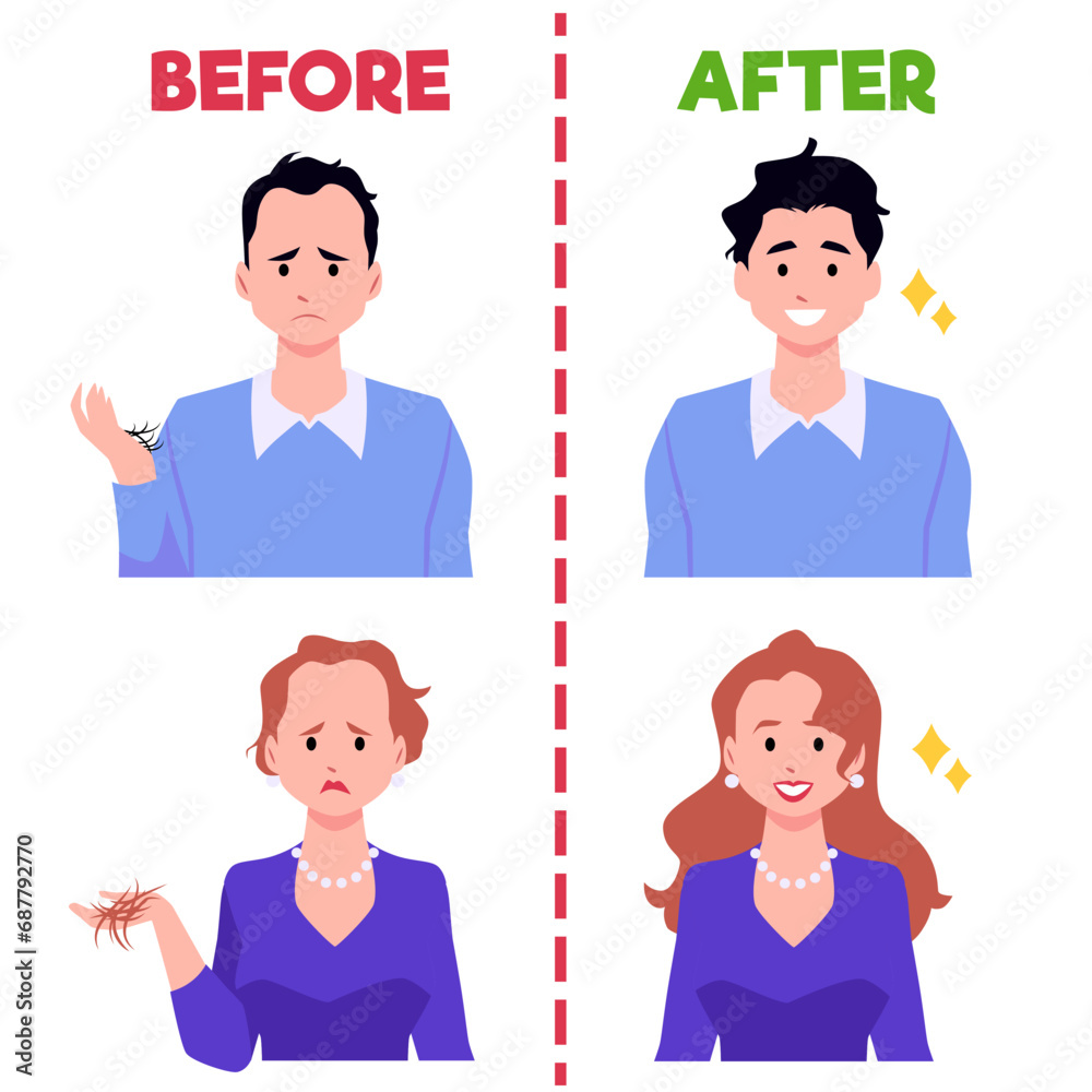 Bald woman and man before and after hair transplantation infographic ...