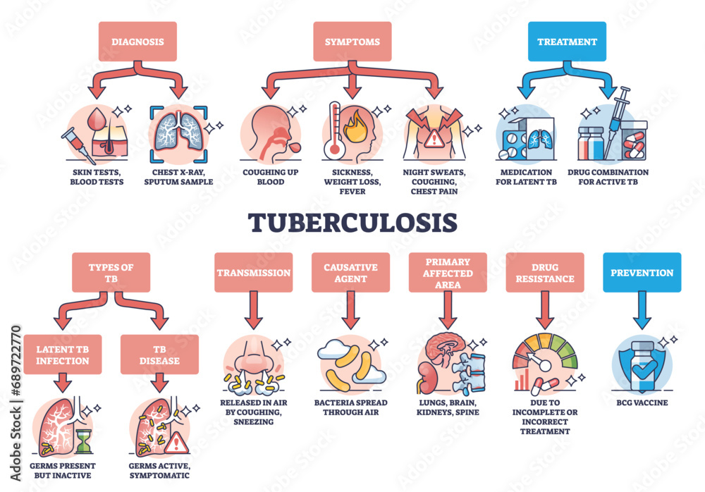 Key aspects of tuberculosis or TB respiratory lung disease outline ...