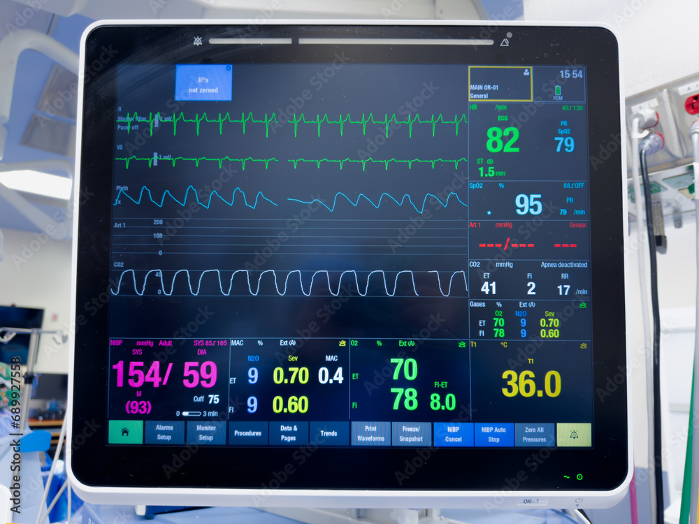 hospital monitor displaying vital signs and hemodynamics, illustrating ...