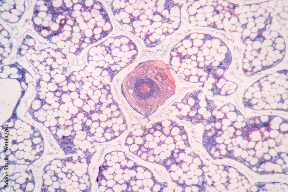 Anatomy and Histological Rea Bone marrow Human, Hyaline cartilage human ...