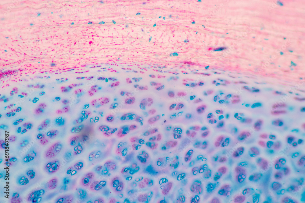 Anatomy and Histological Rea Bone marrow Human, Hyaline cartilage human ...