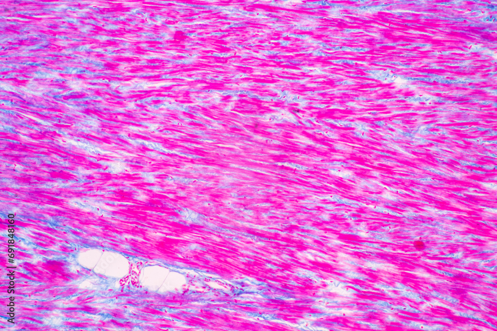 Anatomy and Histological Rea Bone marrow Human, Hyaline cartilage human ...