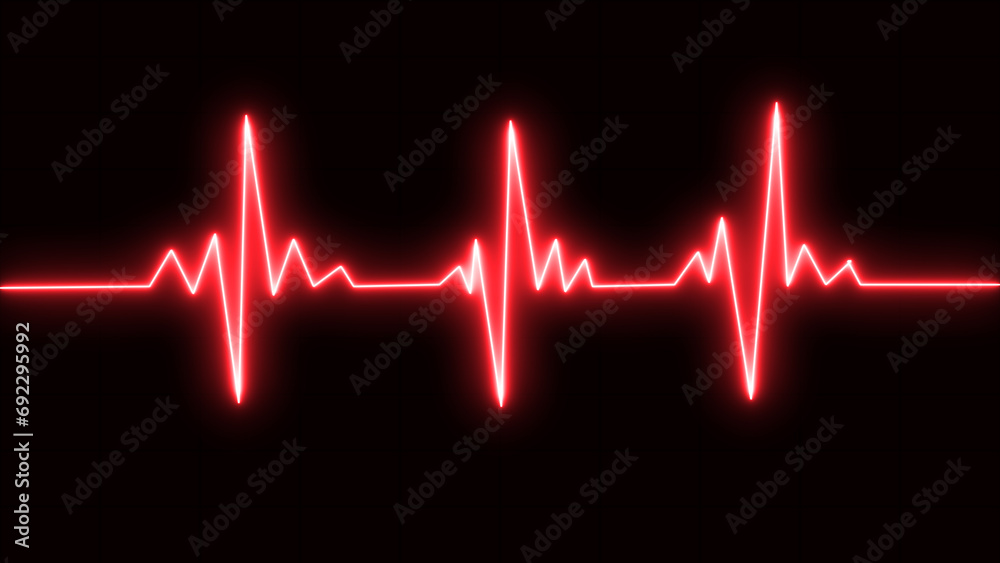 Illustration Stock Electrocardiogram show Premature Ventricular Contraction. Heart beat ...