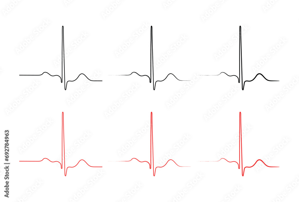 Ventricular repolarization, Cardiac cycle, ECG of heart in normal sinus ...