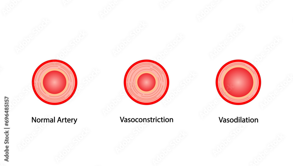 Arterial vasoconstriction and vasodilation. Cross section of arteries ...
