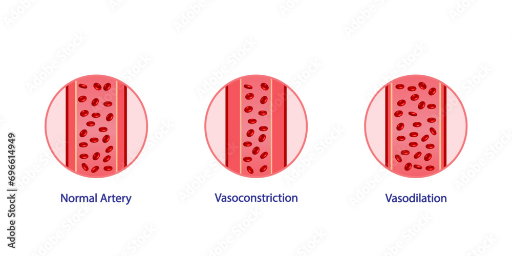 Arterial vasoconstriction and vasodilation. Cross section of arteries ...