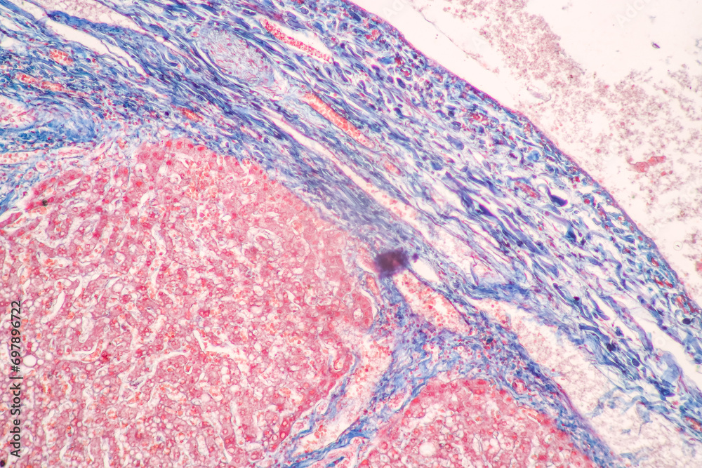 Structure of Tissue of Spleen Human, Liver Human and Kidney Human under ...
