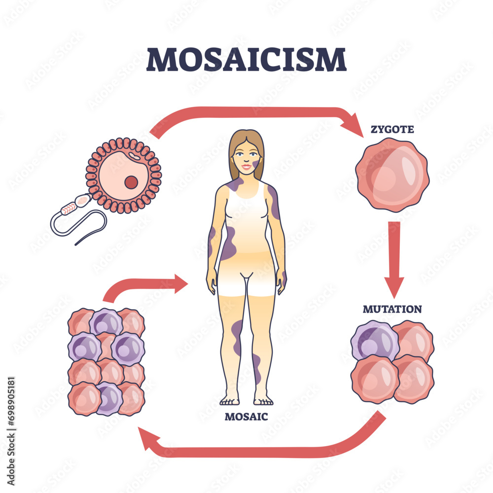 Mosaicism as medical genetic condition with cellular sets defect ...