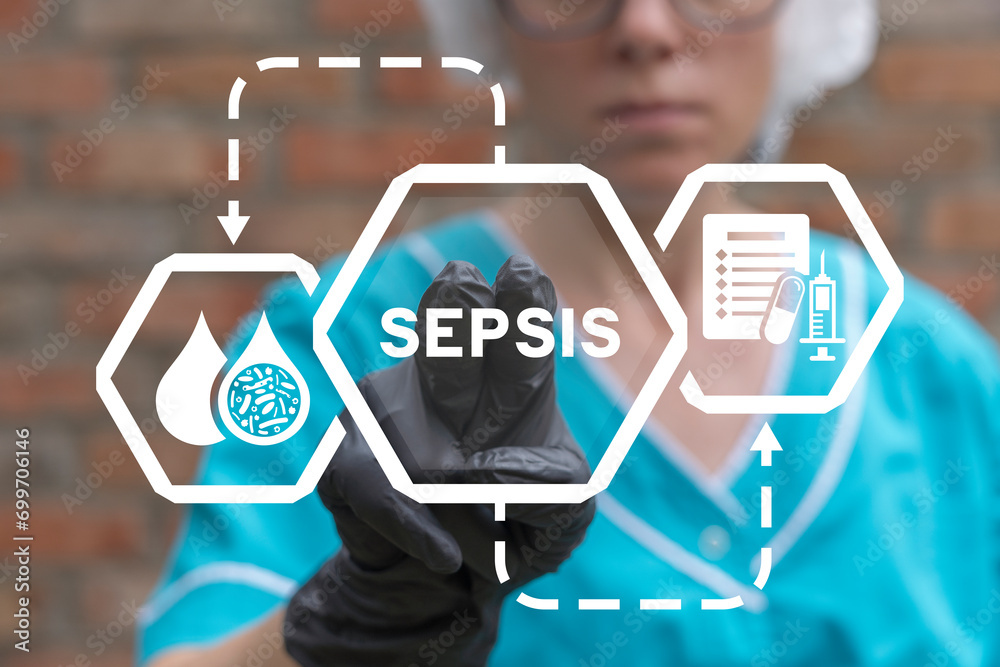 Doctor using virtual interface presses word: SEPSIS. Sepsis medical ...