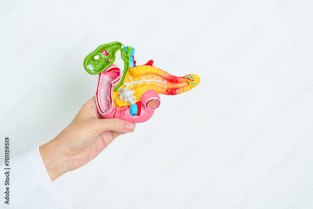 Doctor with human Pancreatitis anatomy model with Pancreas, Gallbladder ...