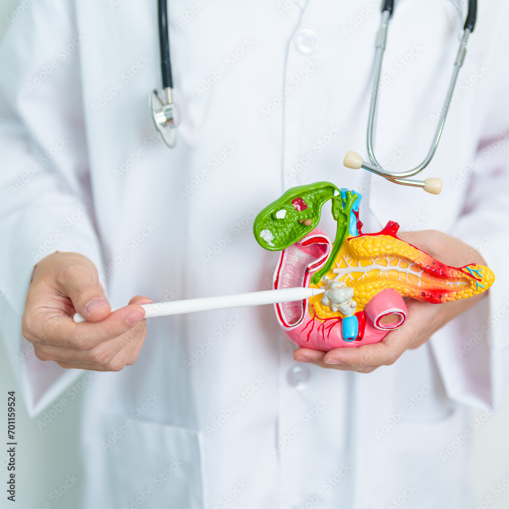 Doctor with human Pancreatitis anatomy model with Pancreas, Gallbladder ...