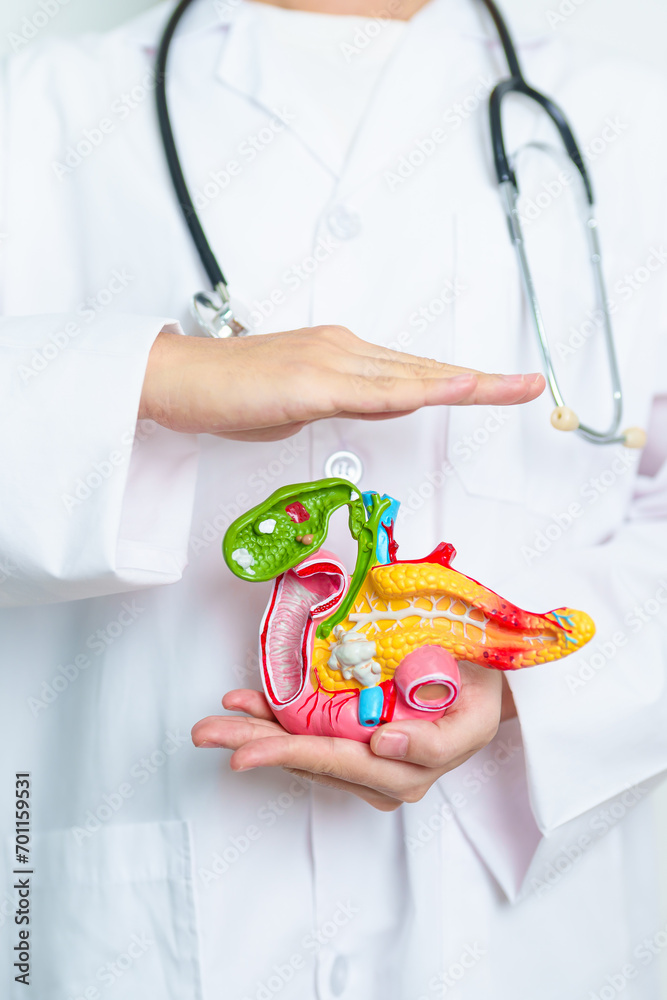 Doctor with human Pancreatitis anatomy model with Pancreas, Gallbladder ...