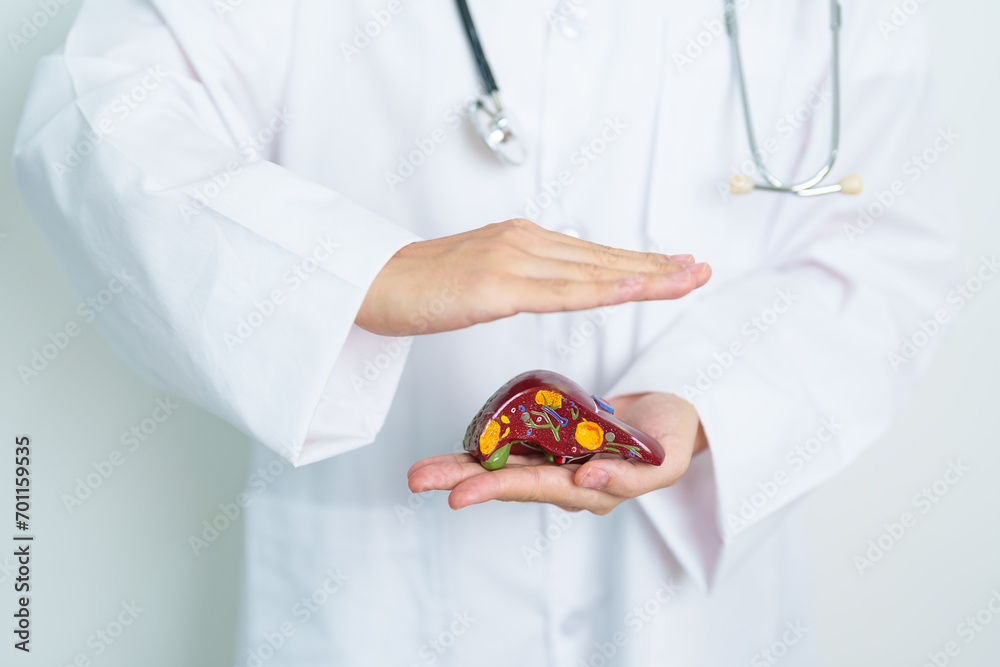 Doctor with human Liver anatomy model. Liver cancer and Tumor, Jaundice ...