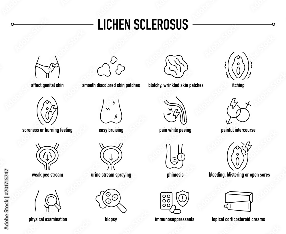Lichen Sclerosus symptoms, diagnostic and treatment vector icons. Line ...