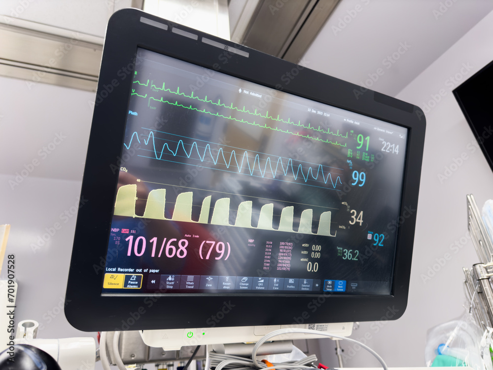 Hospital monitor displays vital signs, healthcare concept, medical equipment, patient health ...