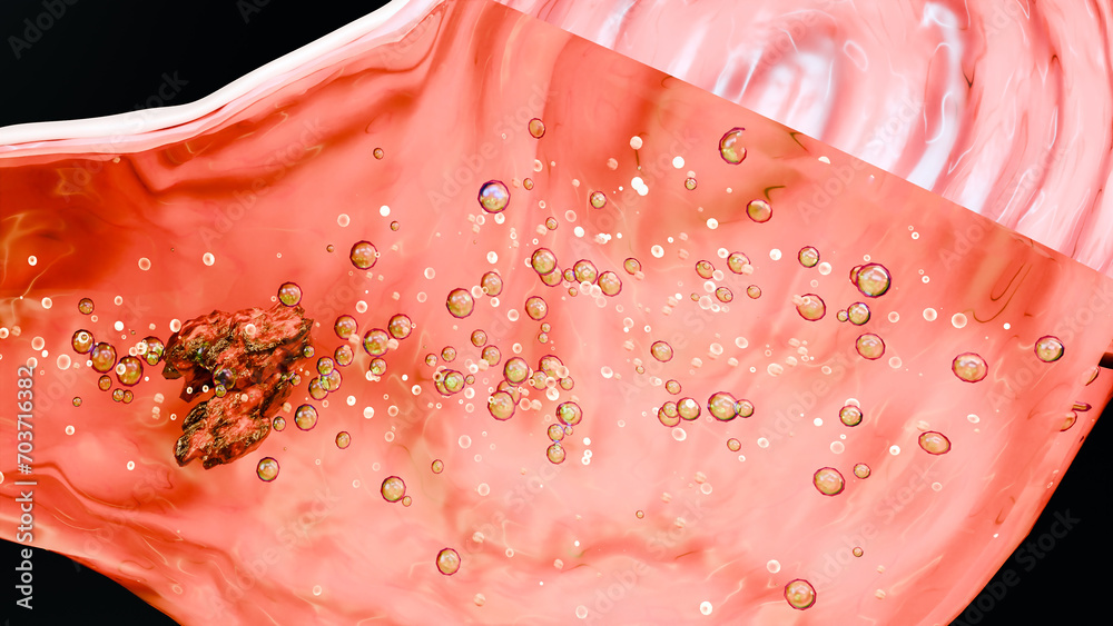 Human Stomach Anatomy Digestion, esophagus abdomen gastric with acid ...