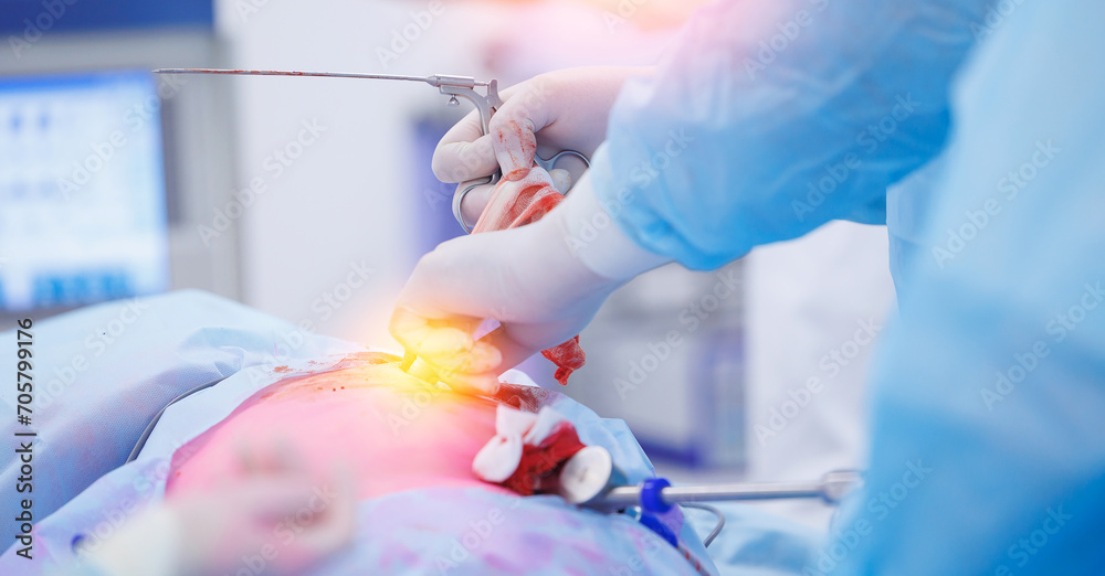 Foto de Stock Closeup surgeon hold surgical equipment in minimal ...