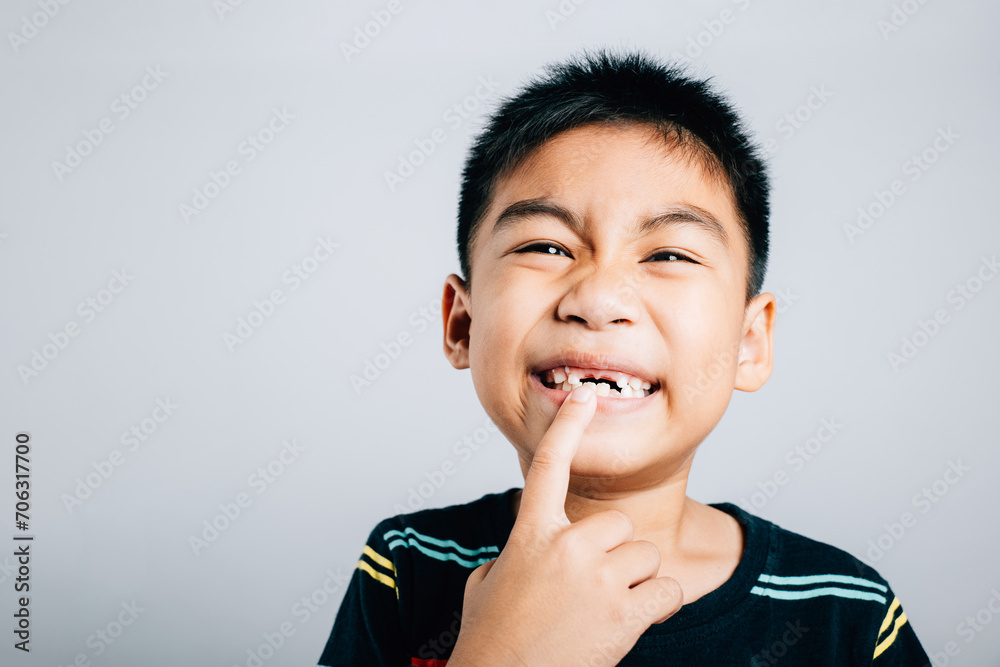 Photo Stock Six year old schoolboy happily points to growing molar gap ...