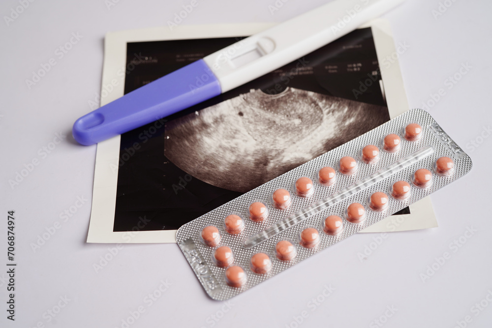 Pregnancy test with ultrasound scan photo of fetus, maternity ...