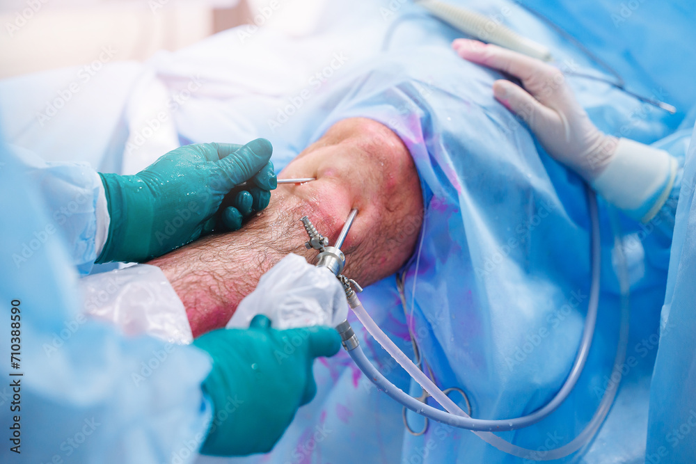 Minimally invasive surgery, suturing tendons and ligaments in knee of ...