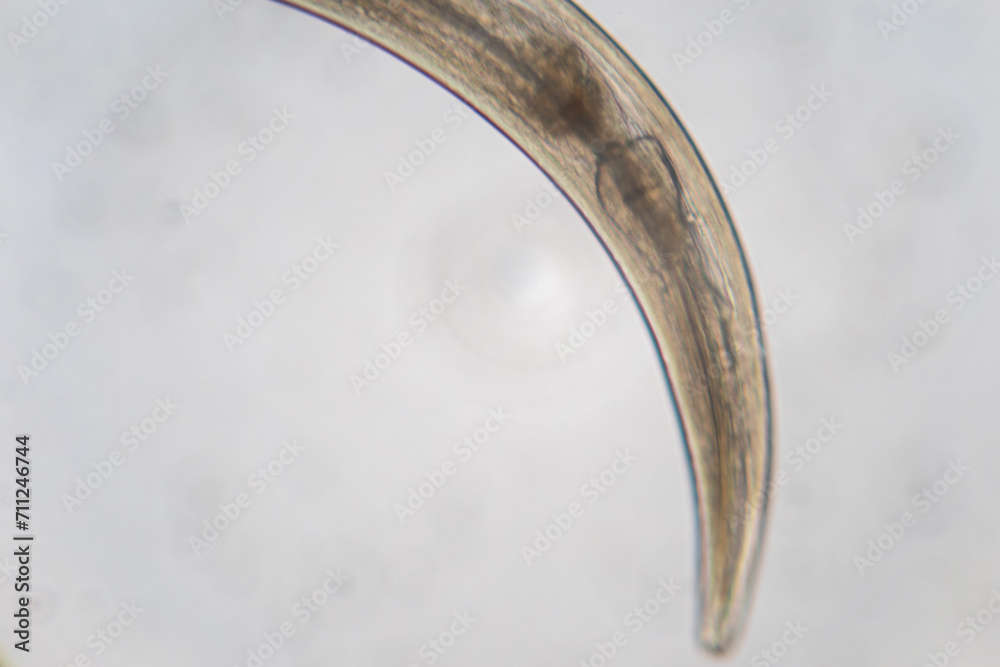 Study of Parasitic helminths (Trematodes) and Ascaris of fishes under a ...