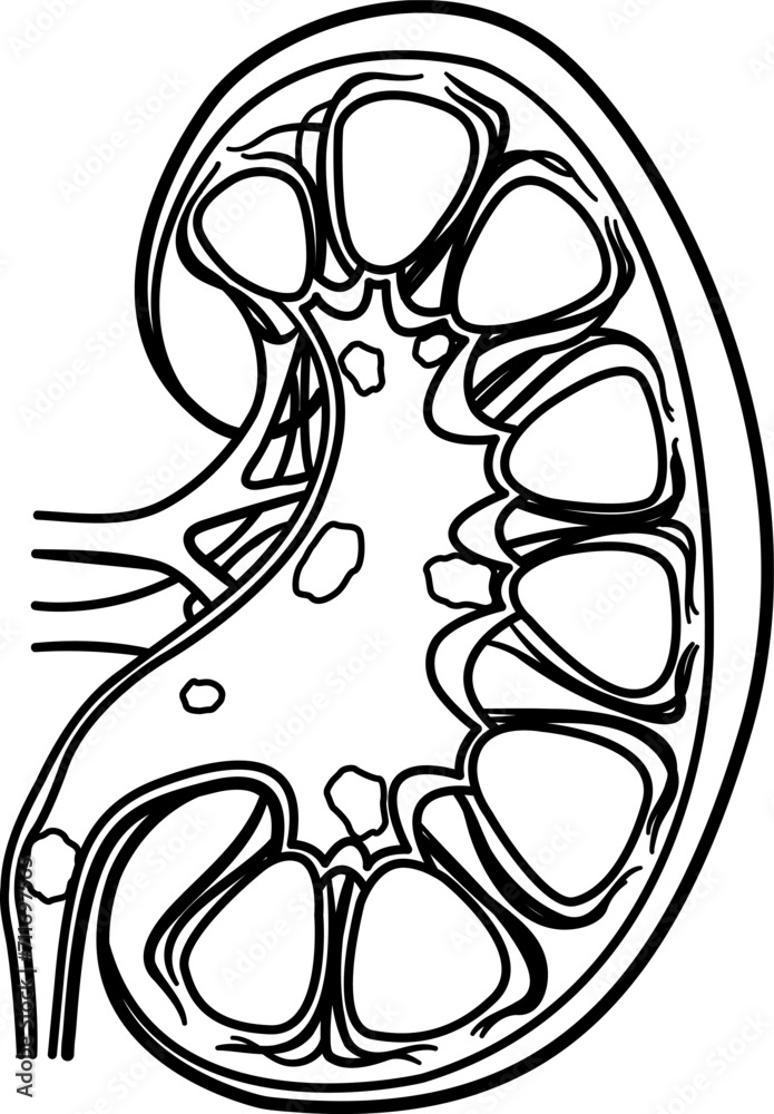 Anatomy of Kidney Stones for Coloring. Medical Concept of Urinary ...
