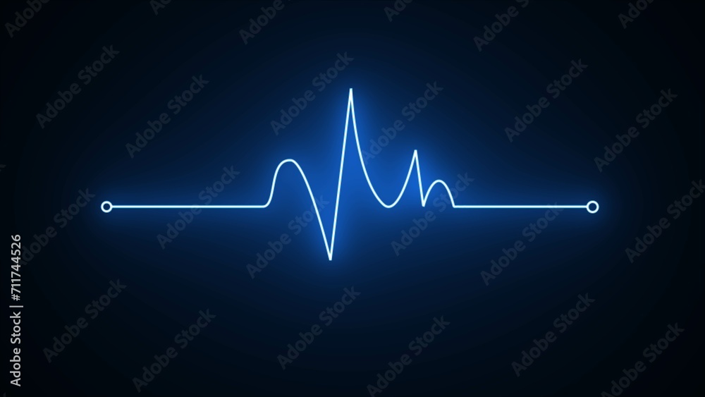Blue neon heartbeat pulse on the image. ECG heart rate monitor. Medical ...