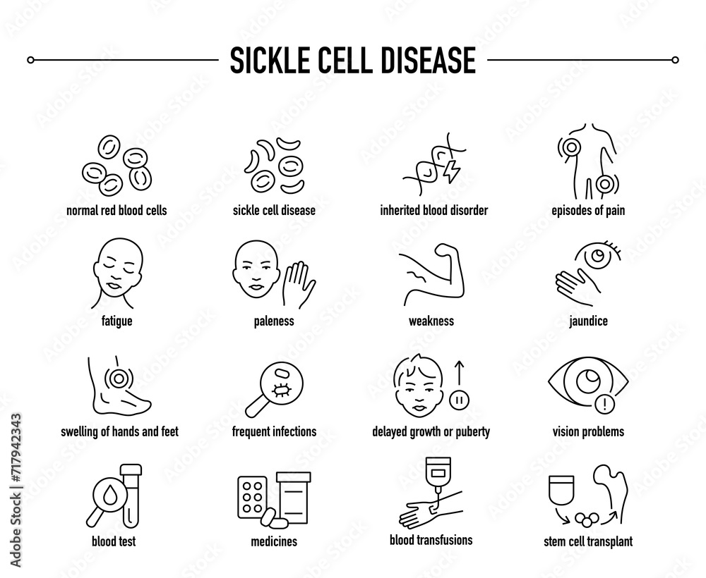 Sickle Cell Disease symptoms, diagnostic and treatment vector icons ...
