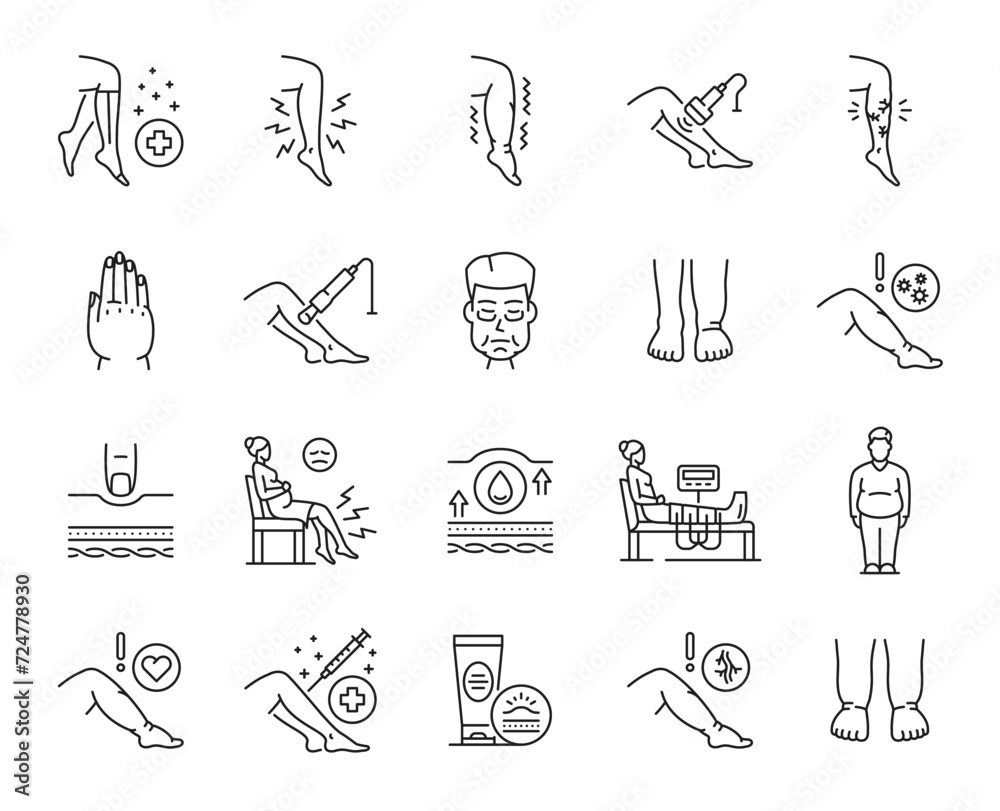Image vectorielle Stock Edema line icons of vector swollen legs, feet ...