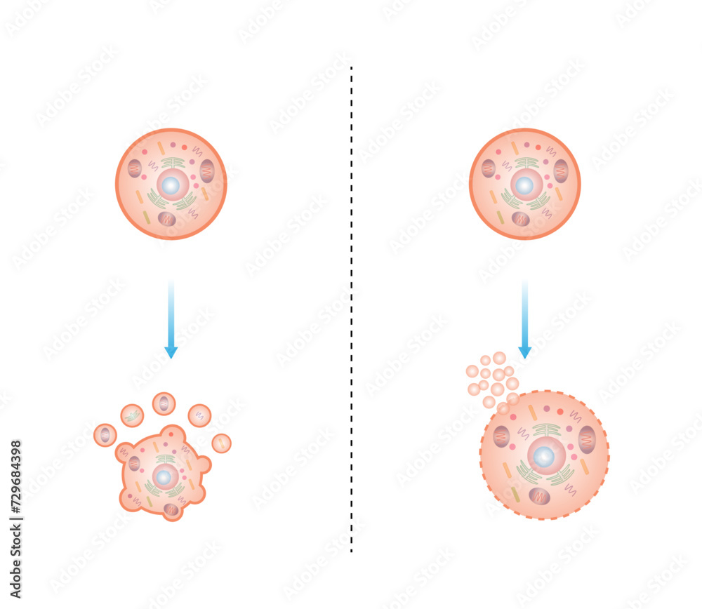 Apoptosis and necrosis of normal cell. Cell death types. Labeled ...
