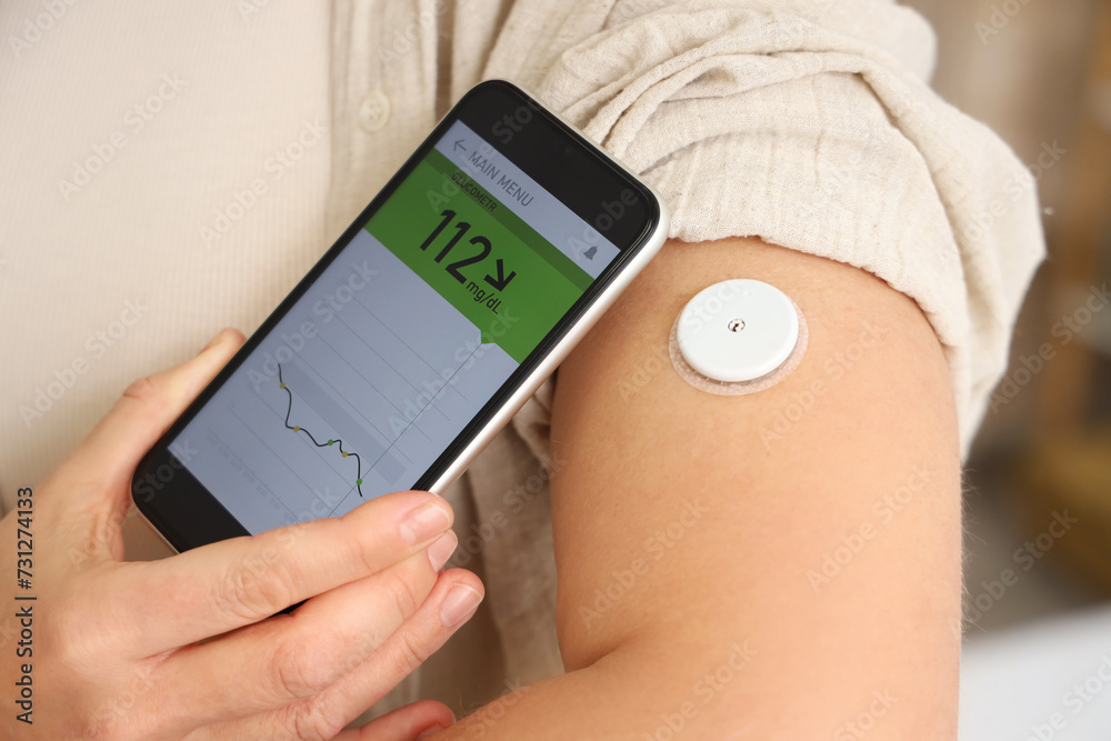 Diabetic woman with glucose sensor using mobile phone for measuring ...