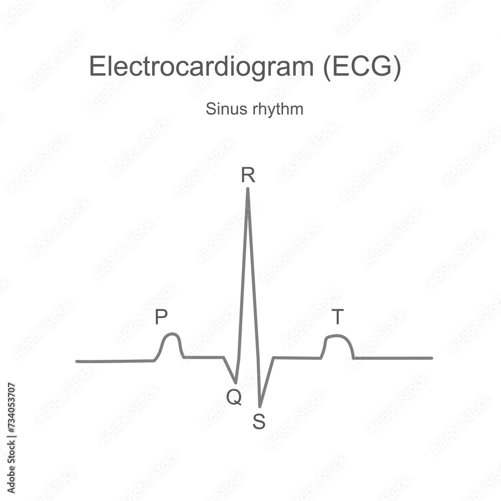 The diagram of Electrocardiogram (ECG) or Electrocardiography (EKG ...