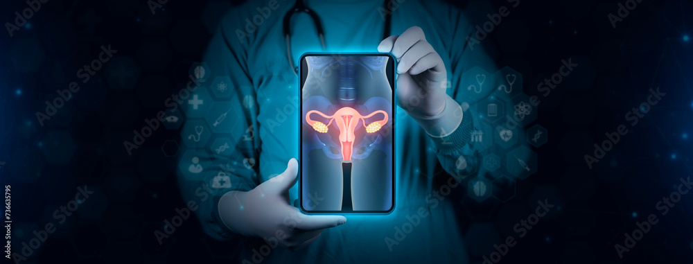 Photo Stock Image of a T-shaped contraceptive intrauterine device ...